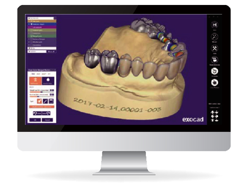 digital-orthodontics_img16 CAD